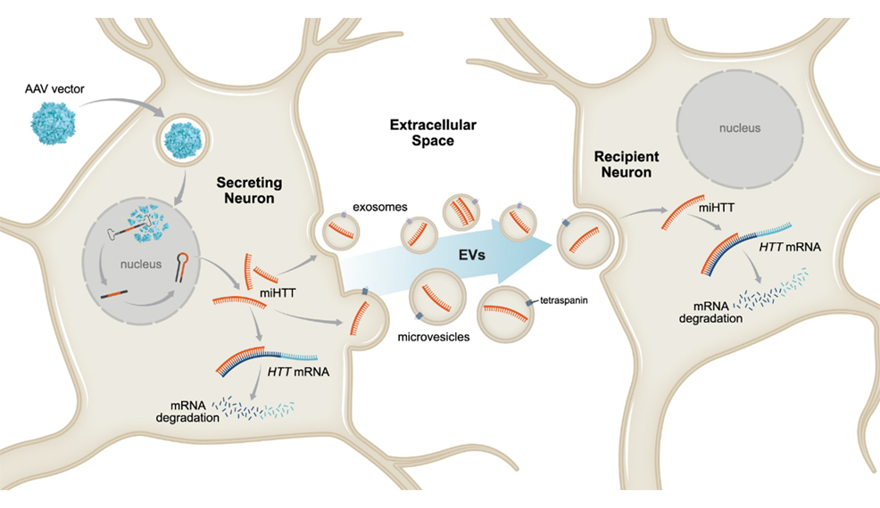 Breakthrough in treatment of Huntington's disease